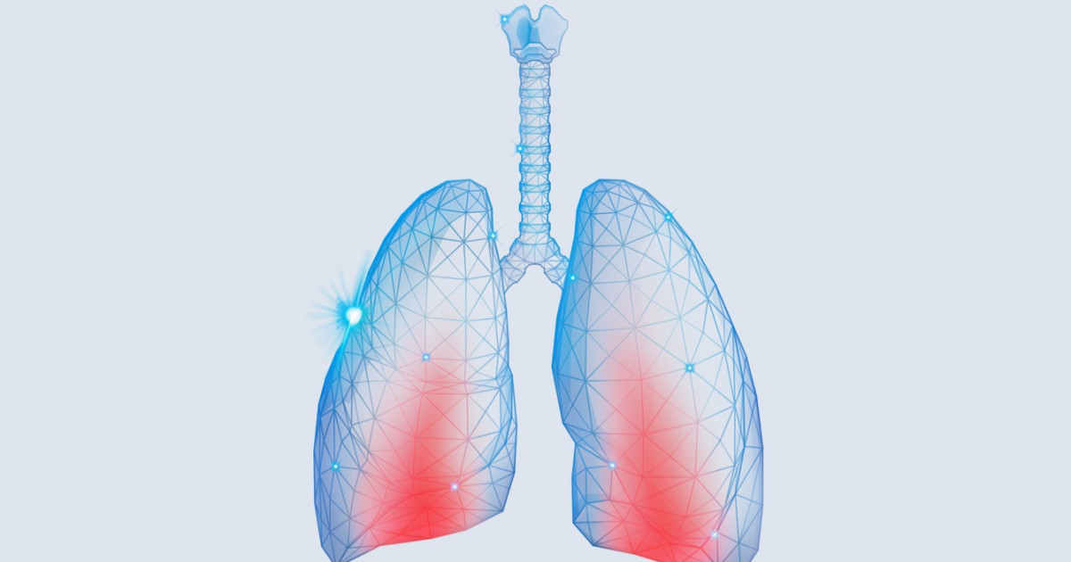 Respiračný balík | Medirex